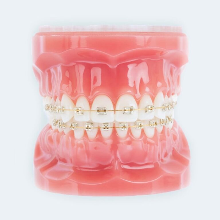 Our Orthodontic Treatments | Dougherty Orthodontics | St. Louis